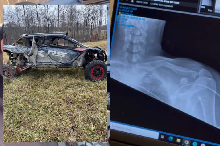 Jelly Roll Reveals He Broke His Collarbone In ATV Accident, Admits He ...